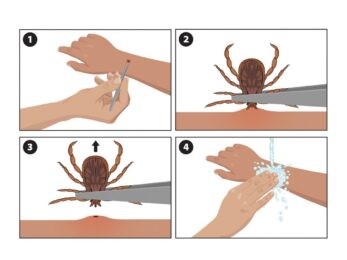 Don't Let Ticks Scare You - Tales of a Mountain Mama